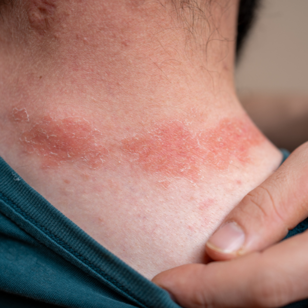 Home - Skin Health Institute - Skin Health Institute